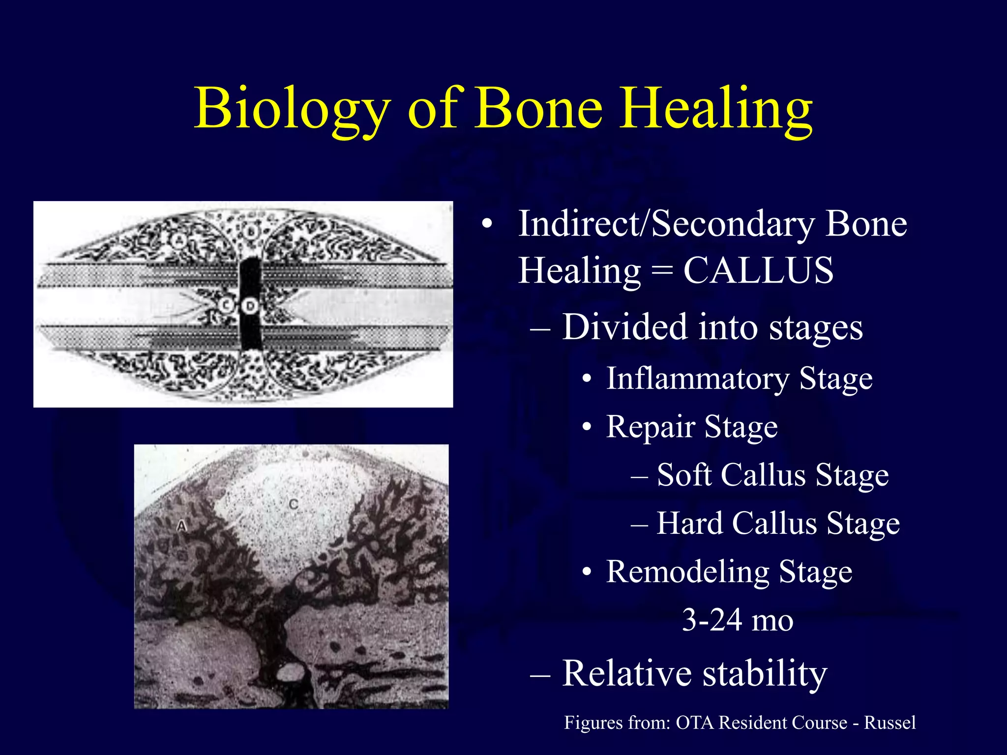 G10_Internal_Fix_Principles.ppt