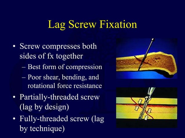 G10_Internal_Fix_Principles.ppt