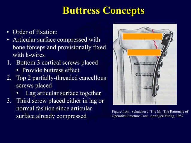 G10_Internal_Fix_Principles.ppt