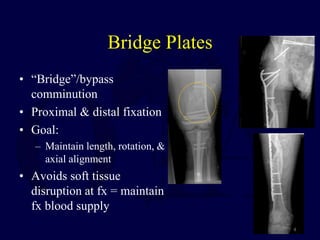 G10_Internal_Fix_Principles.ppt