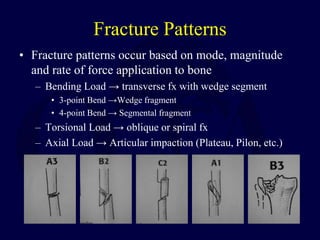 G10_Internal_Fix_Principles.ppt