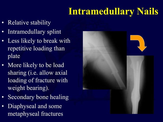 G10_Internal_Fix_Principles.ppt