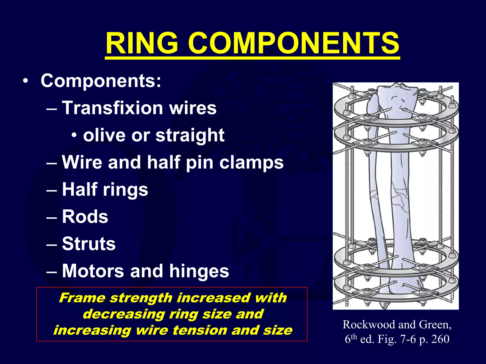 G11-Principles of External Fixation.pdf