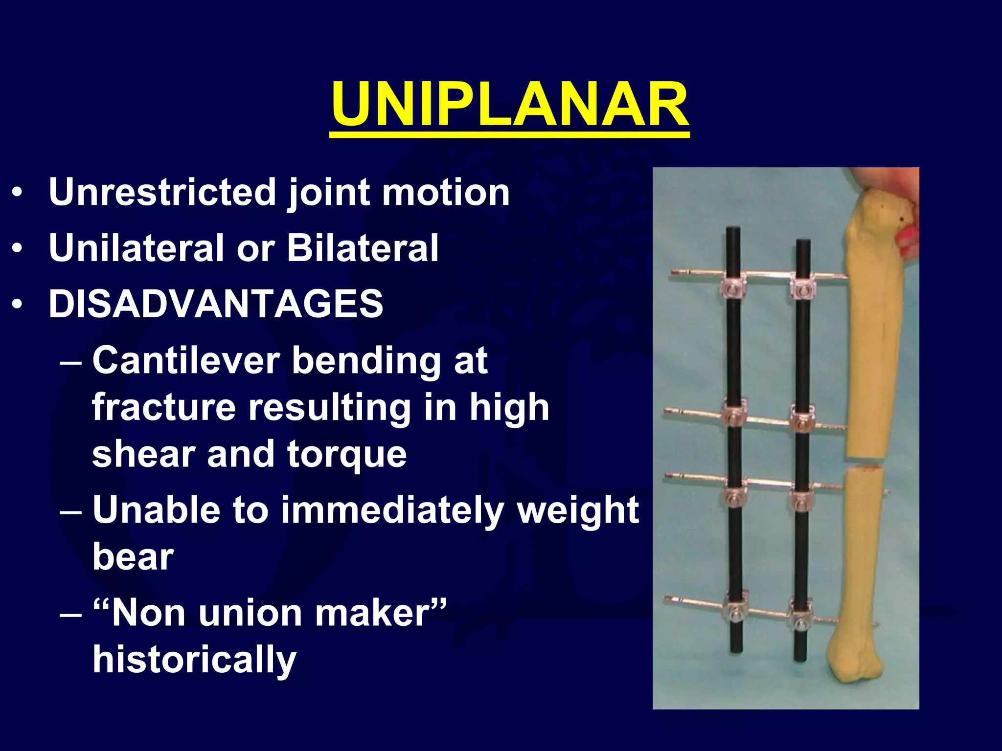 G11-Principles of External Fixation.pdf