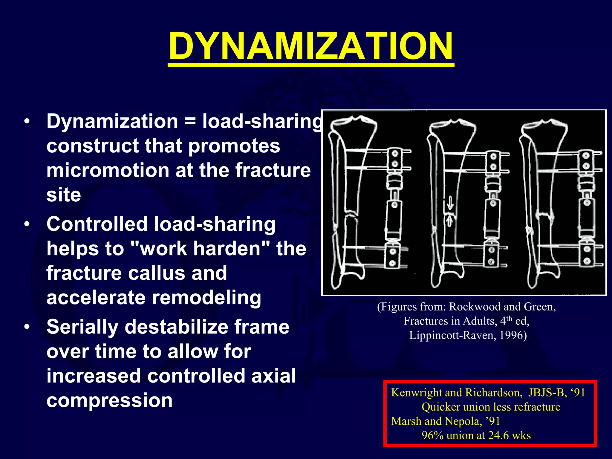 G11-Principles of External Fixation.pdf