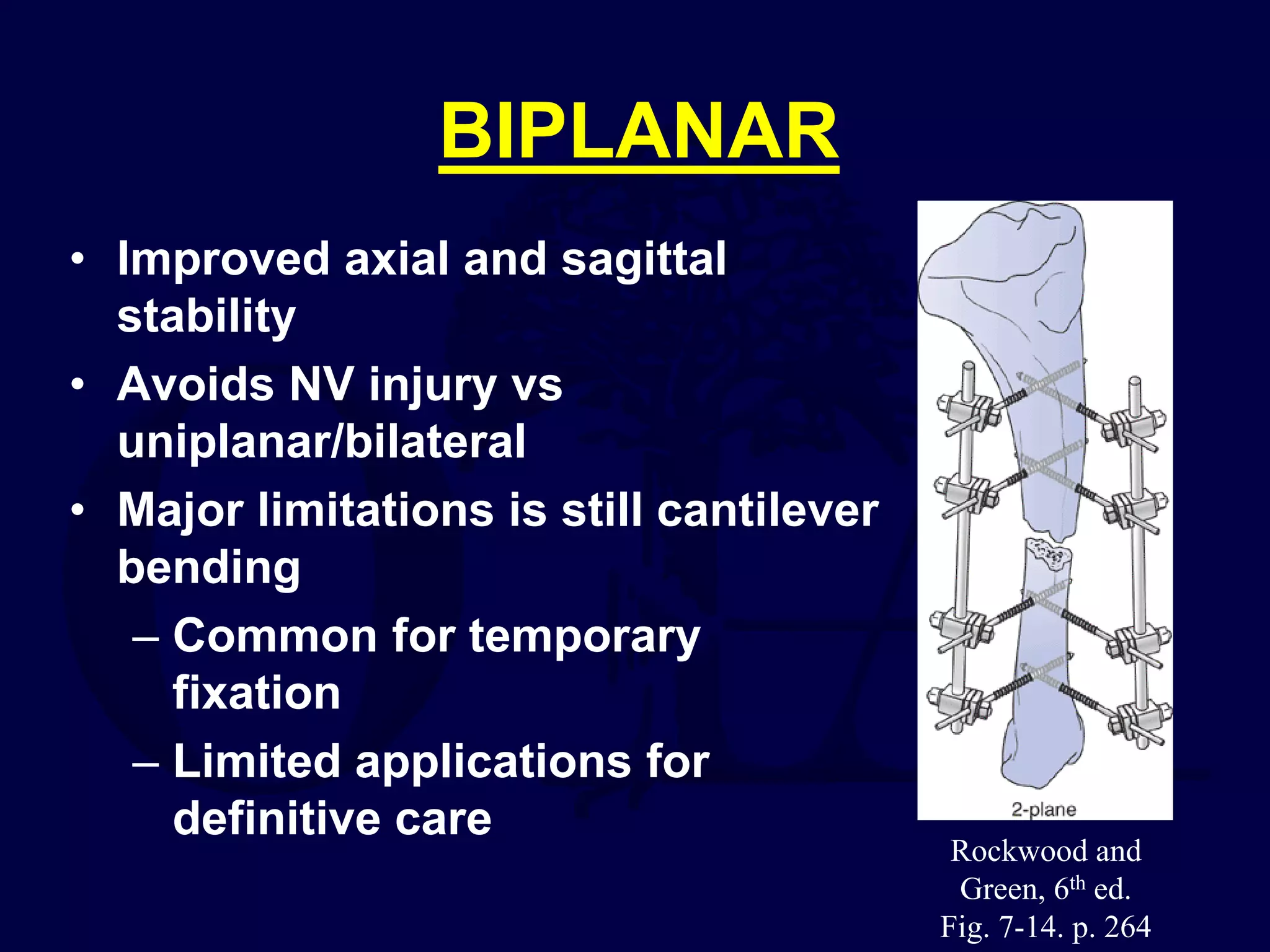 G11-Principles of External Fixation.pdf