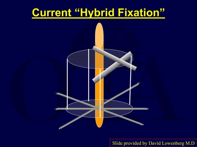 G11-Principles of External Fixation.pdf