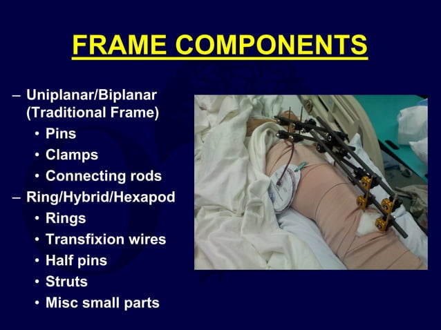 G11-Principles of External Fixation.pdf