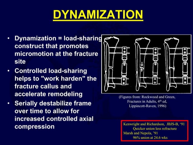 G11-Principles of External Fixation.pdf