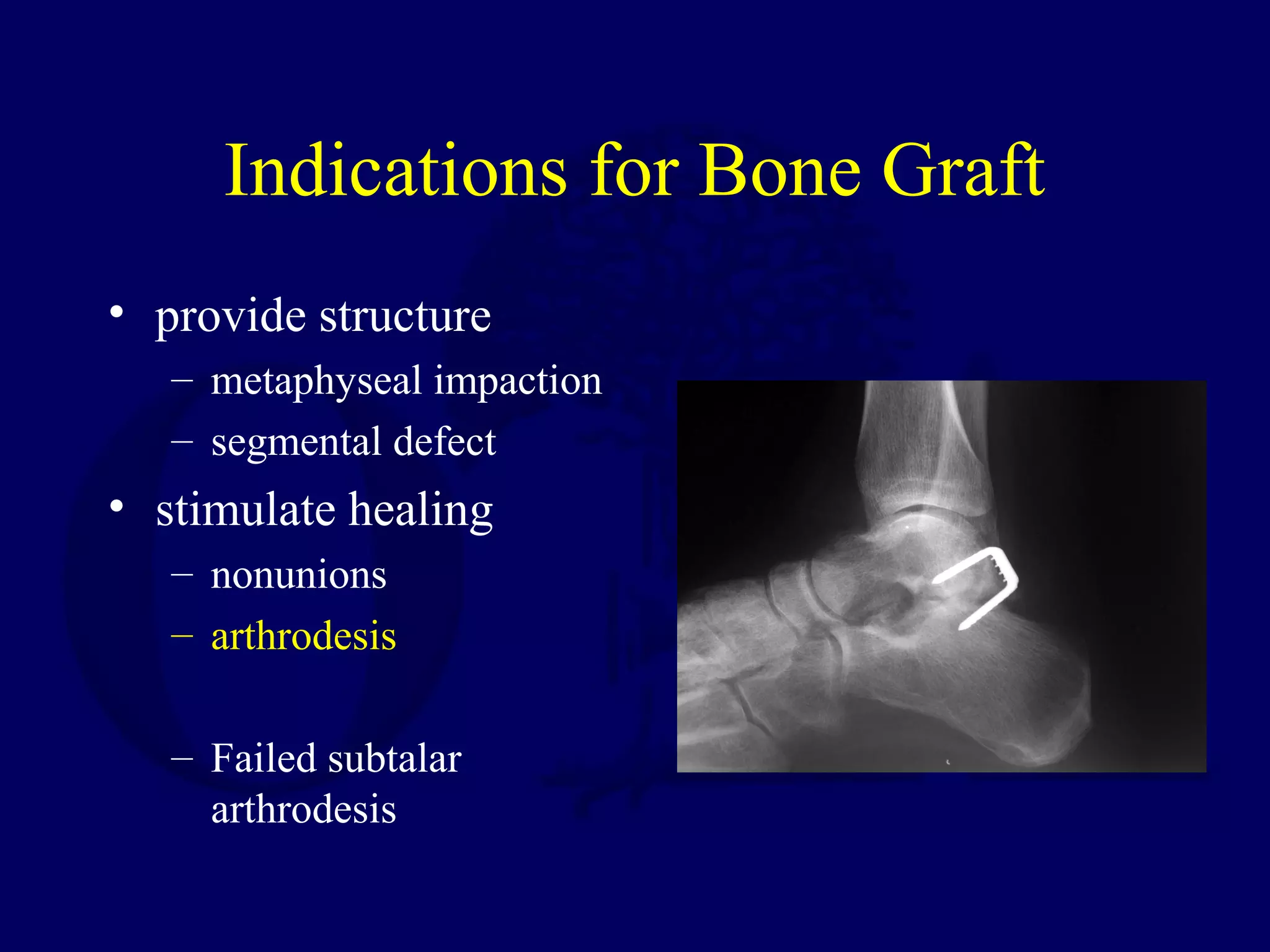 G12 bone grafts & subs | PPT