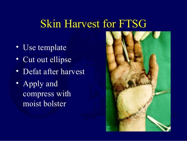 G15 soft tissue coverage