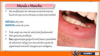 LESÕES FUNDAMENTAIS | PPT