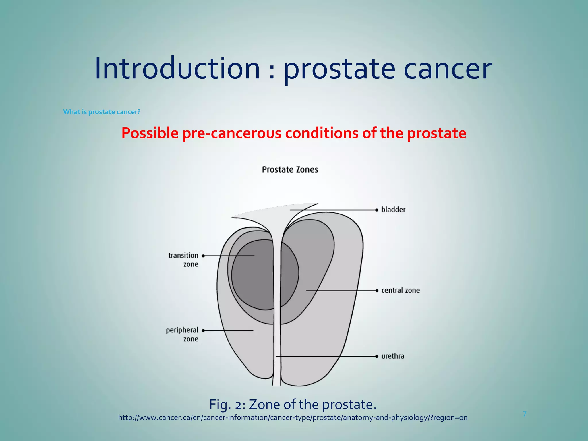 Brachytherapy: Prostate Cancer | PPT