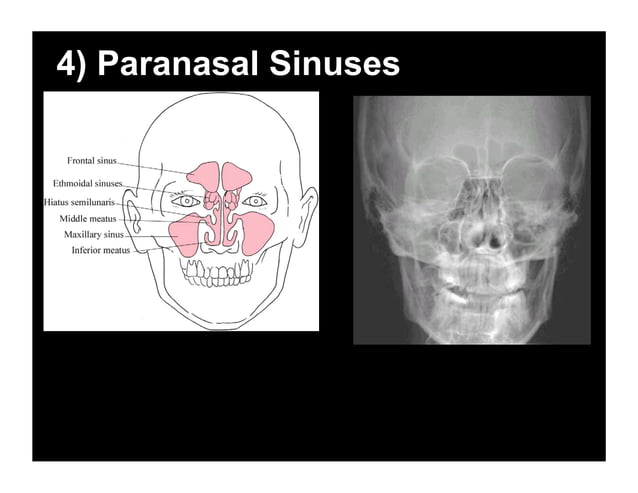 Anatomy of pterygopalatine fossa.ppt.pdf | Ear, Nose and Throat ...