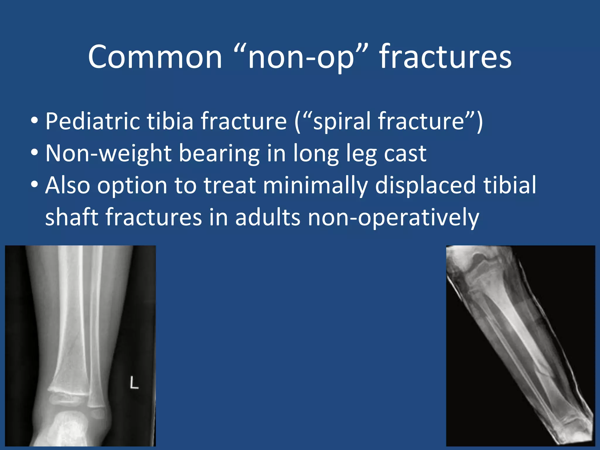 ortho-trauma-presentation | PPTX