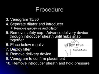 G2 filter placement | PPT
