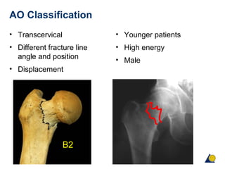 Femoral neck | PPT
