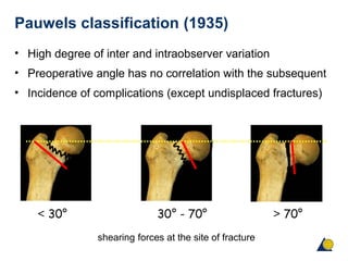 Femoral neck | PPT