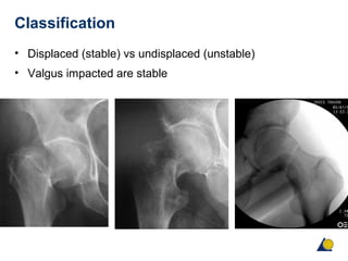 Femoral neck | PPT