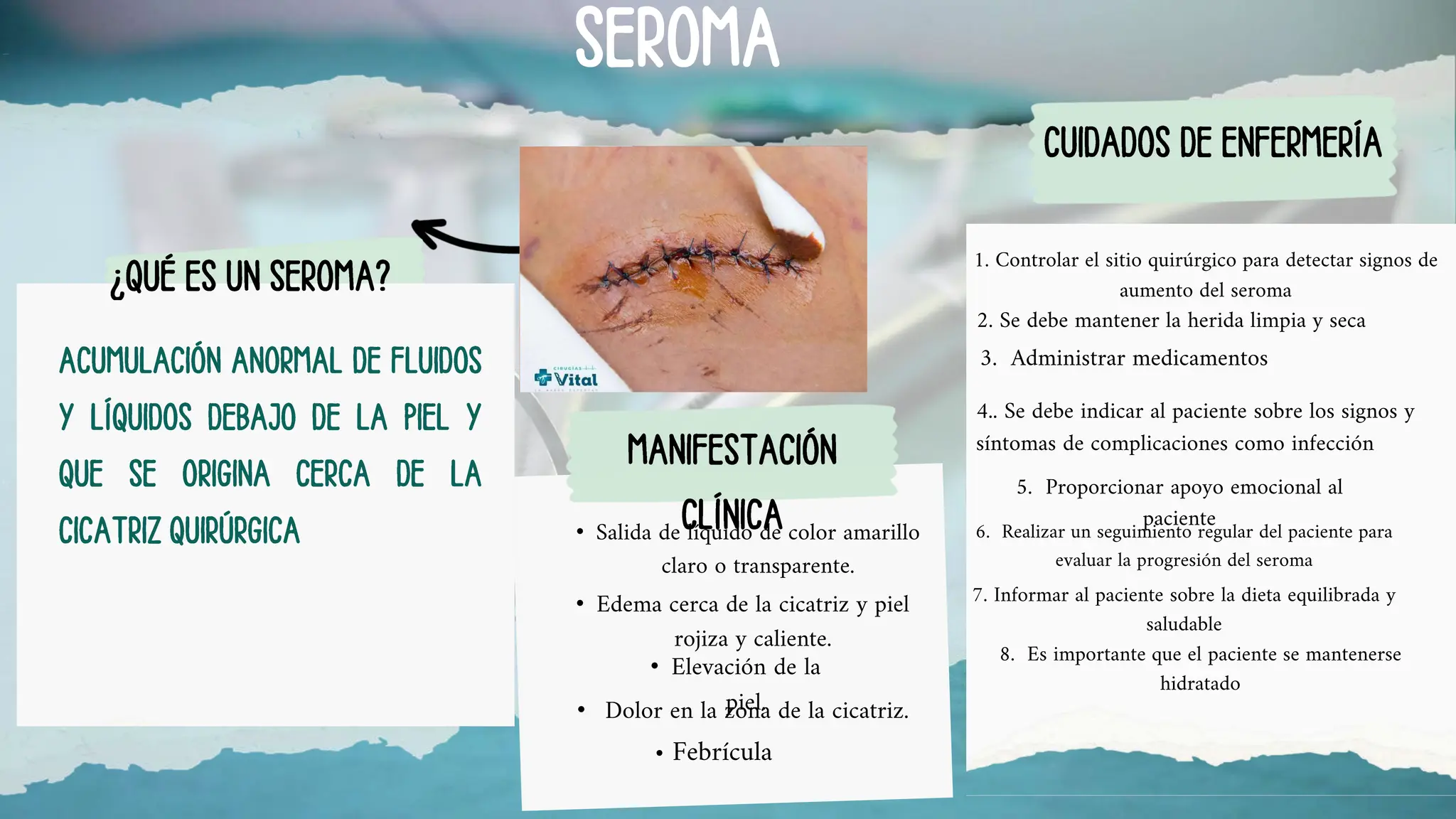 G3 DESHISCENCIA, SEROMAS Y TRASTORNOS DE CICATRIACIÓN (1) (1).pptx