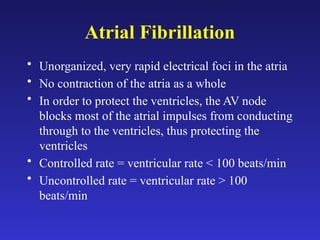 g459h_supraventricular-tachycardia ecg.pptx
