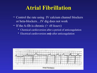 g459h_supraventricular-tachycardia ecg.pptx