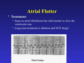 g459h_supraventricular-tachycardia ecg.pptx