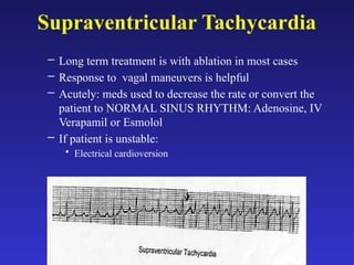 g459h_supraventricular-tachycardia ecg.pptx