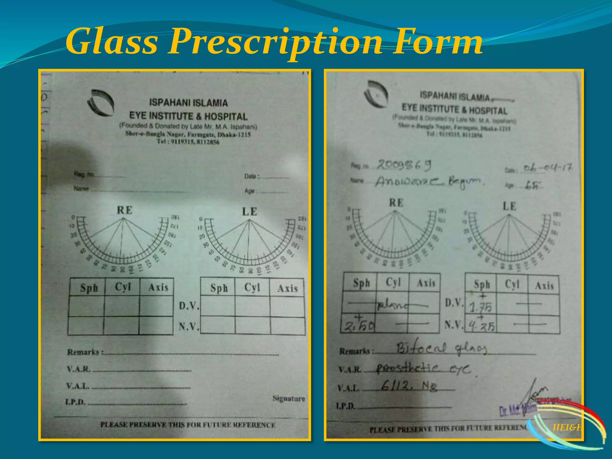 Glass Prescription | PPTX