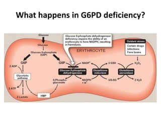 G6pd | PPTX