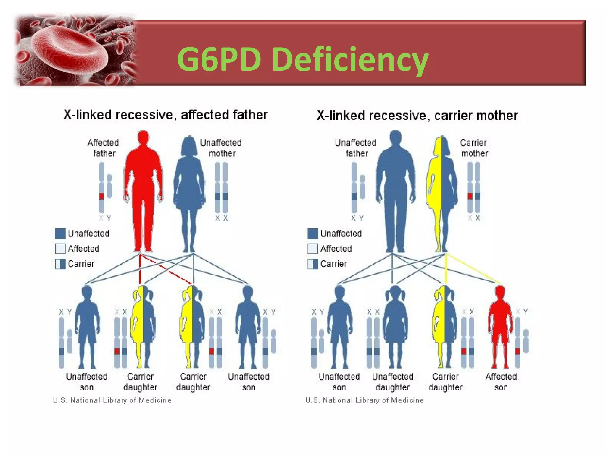 G6PD Deficiency Anaemai | PPT