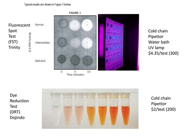 G6PD deficiency diagnosis enzyme summary.pdf | Blood Disorders ...