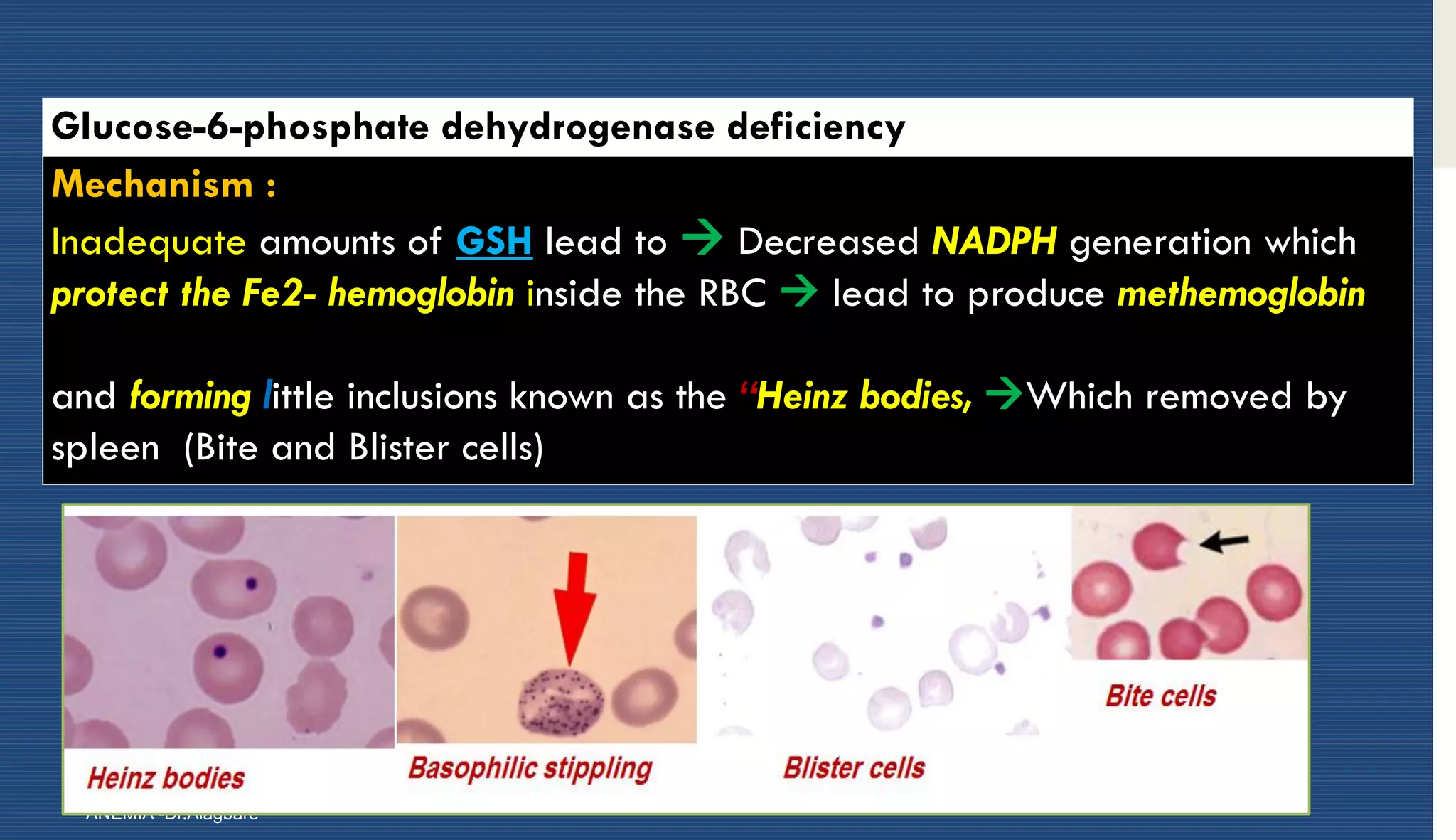 G6pd deficiency | PDF