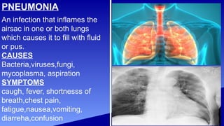 Clinical Pathology on the Respiratory System | PPT