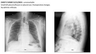 Autopsy conference | PPTX | Heart and Cardiovascular Diseases ...