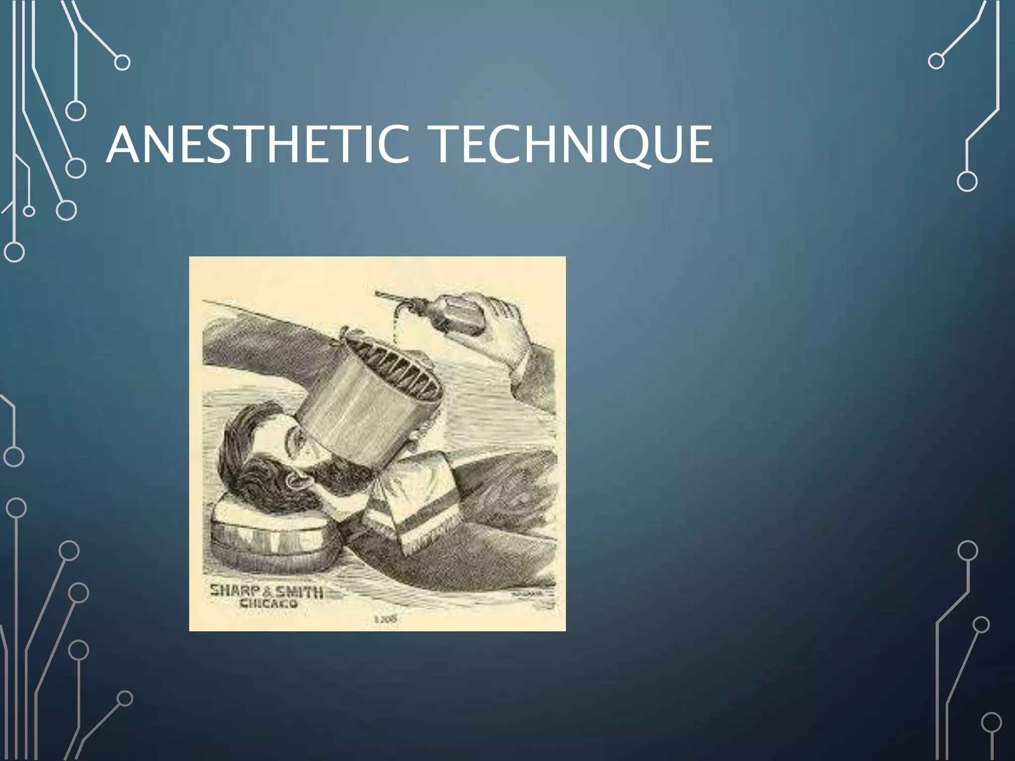 General Anesthesia | PPT