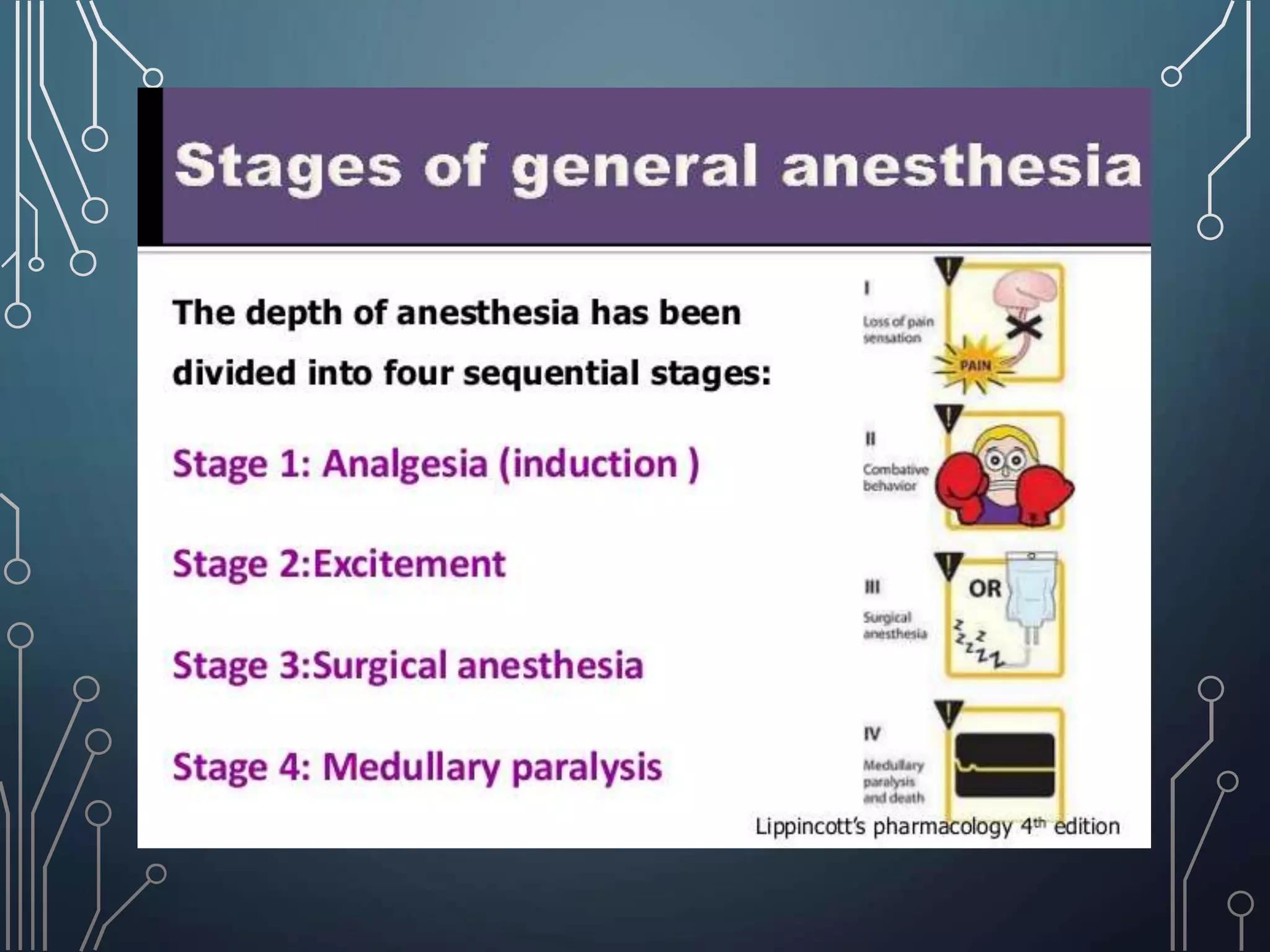 General Anesthesia | PPT