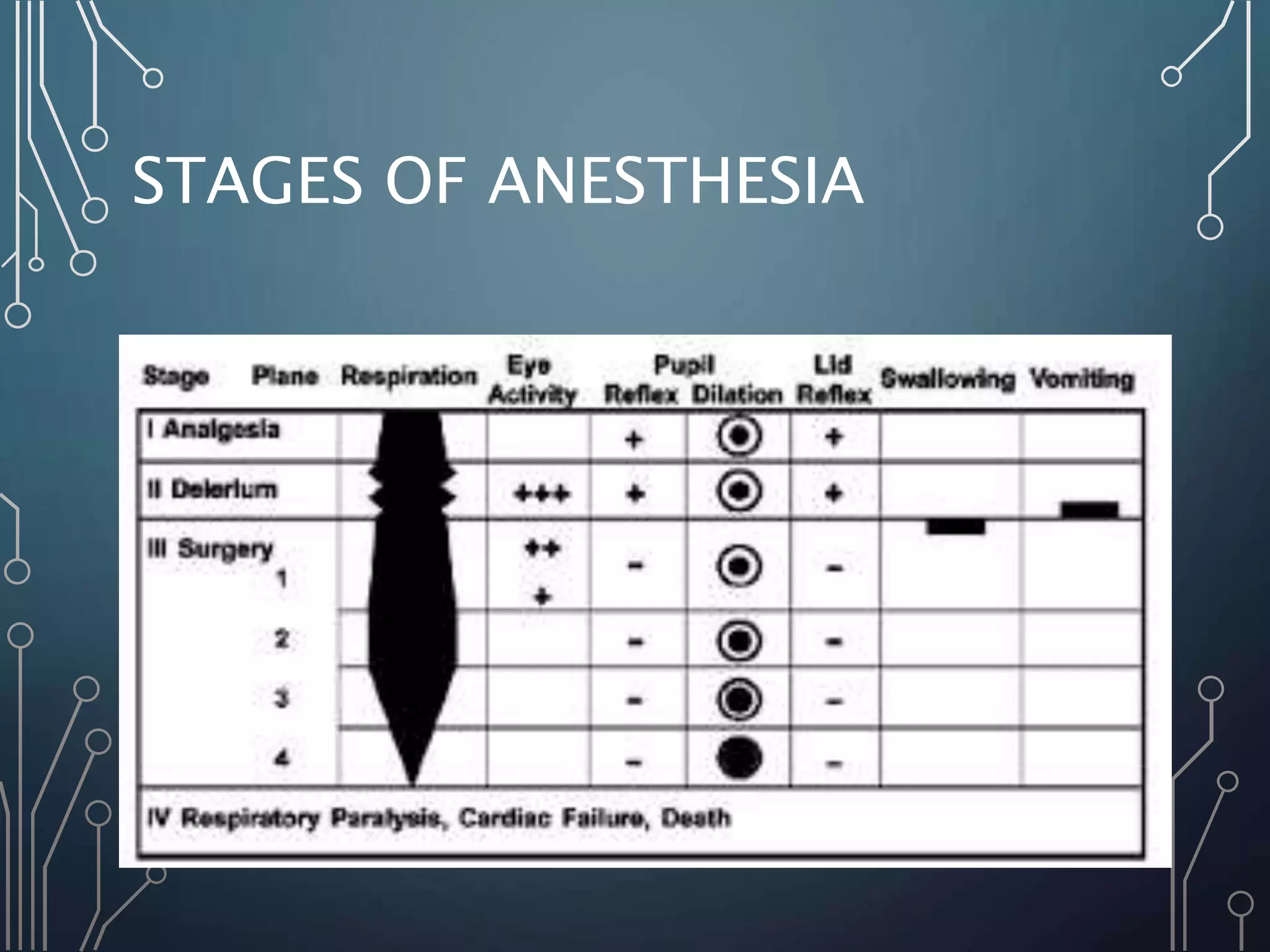 General Anesthesia | PPT