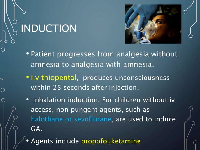General Anesthesia | PPT