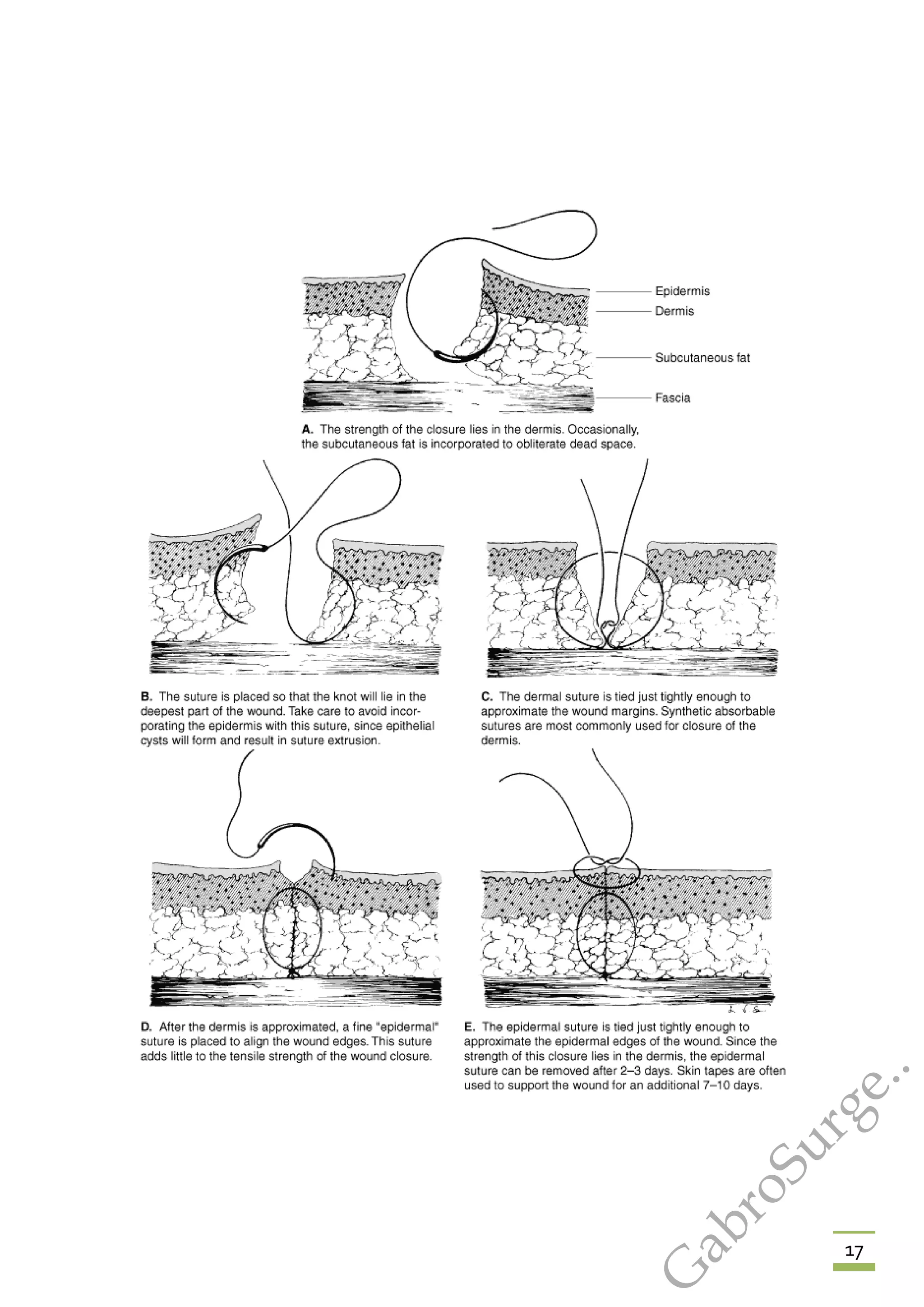 Basic wound management | PDF