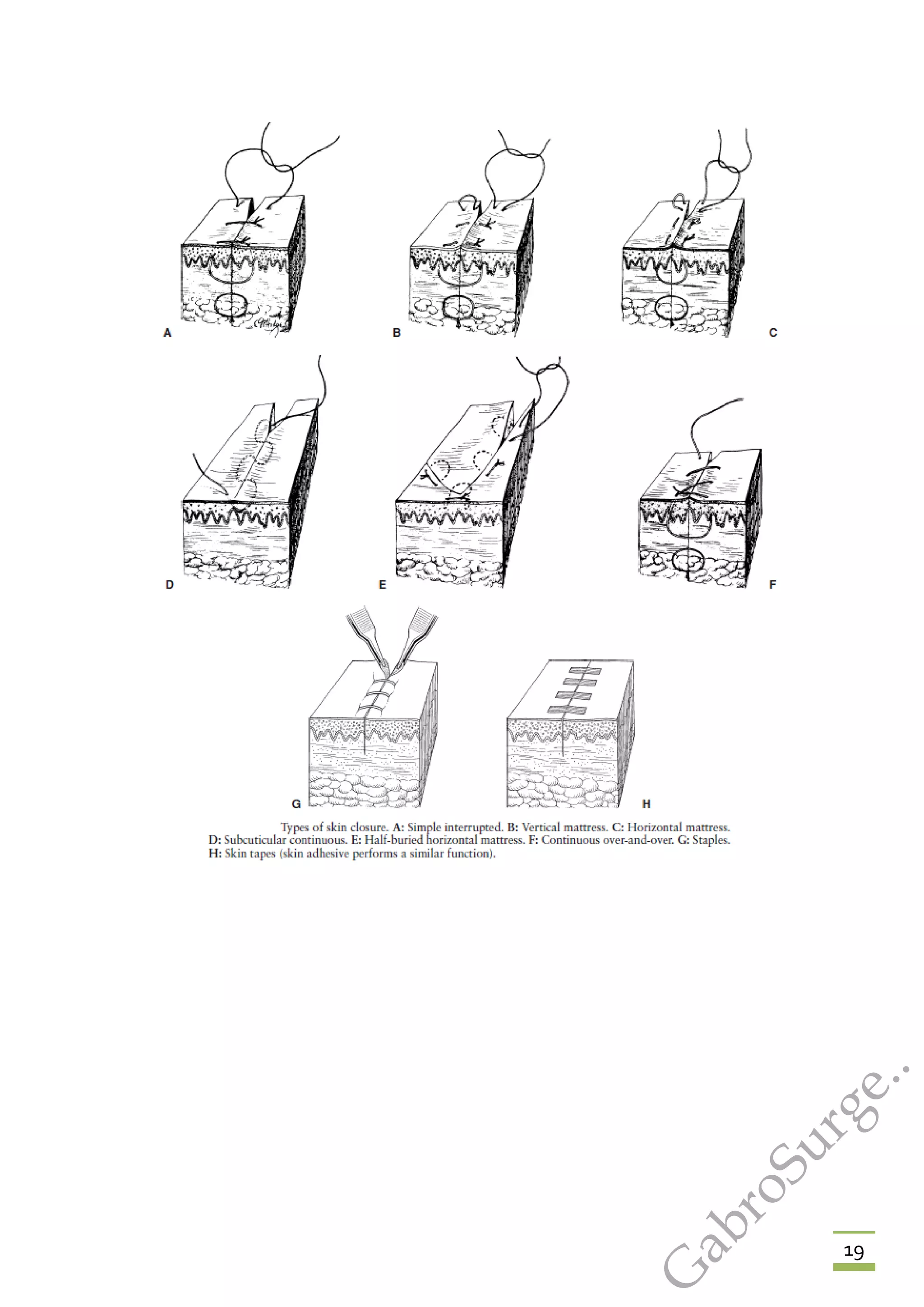 Basic wound management | PDF