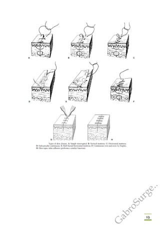 Basic wound management | PDF
