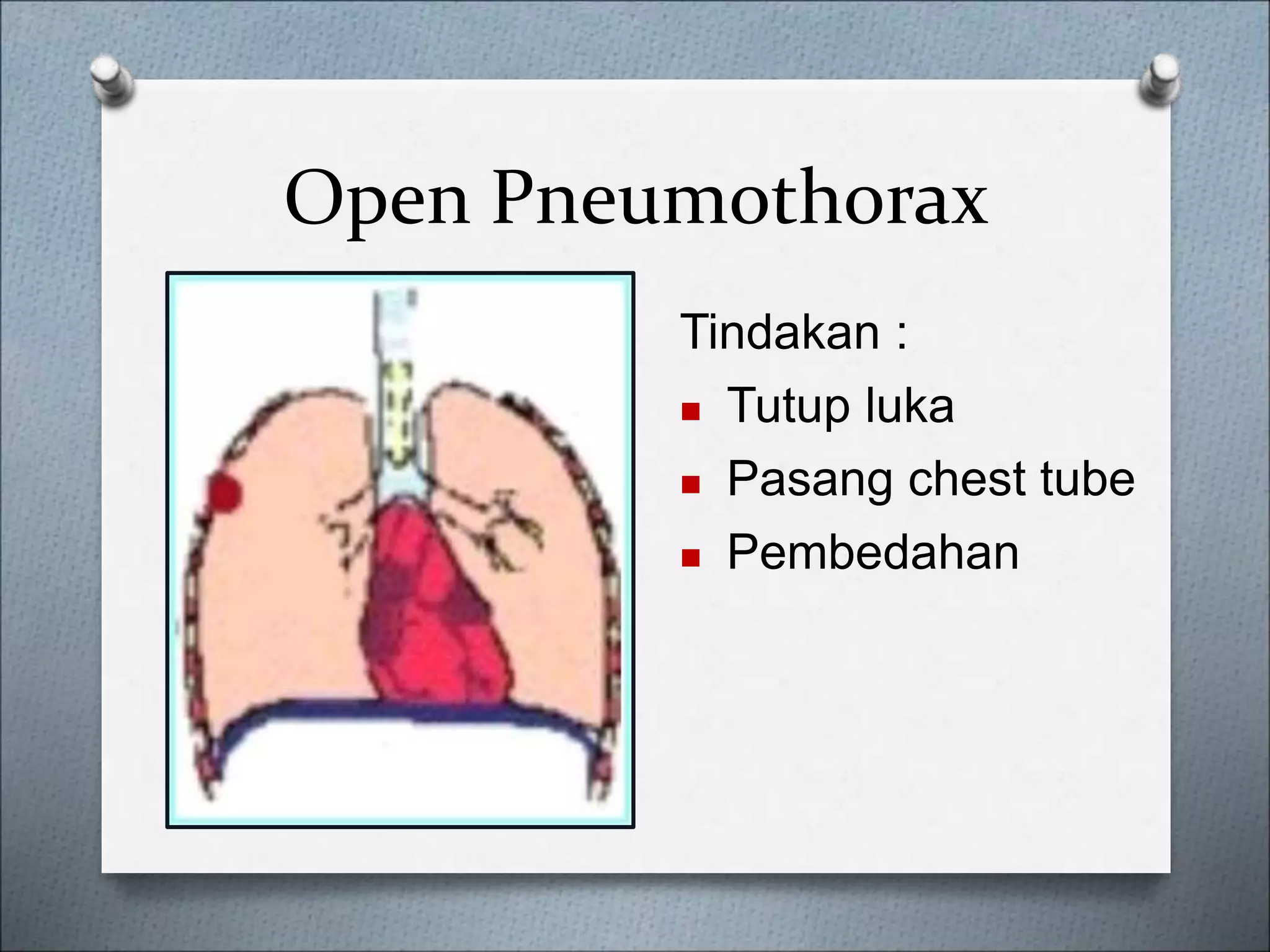 Gadar askep trauma thorax | PPT