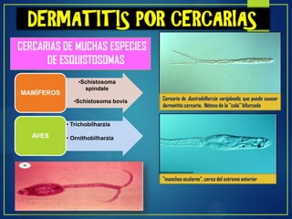 Gnathostomiasis-Anizakiasis- Dermatitis por cercarias | PDF