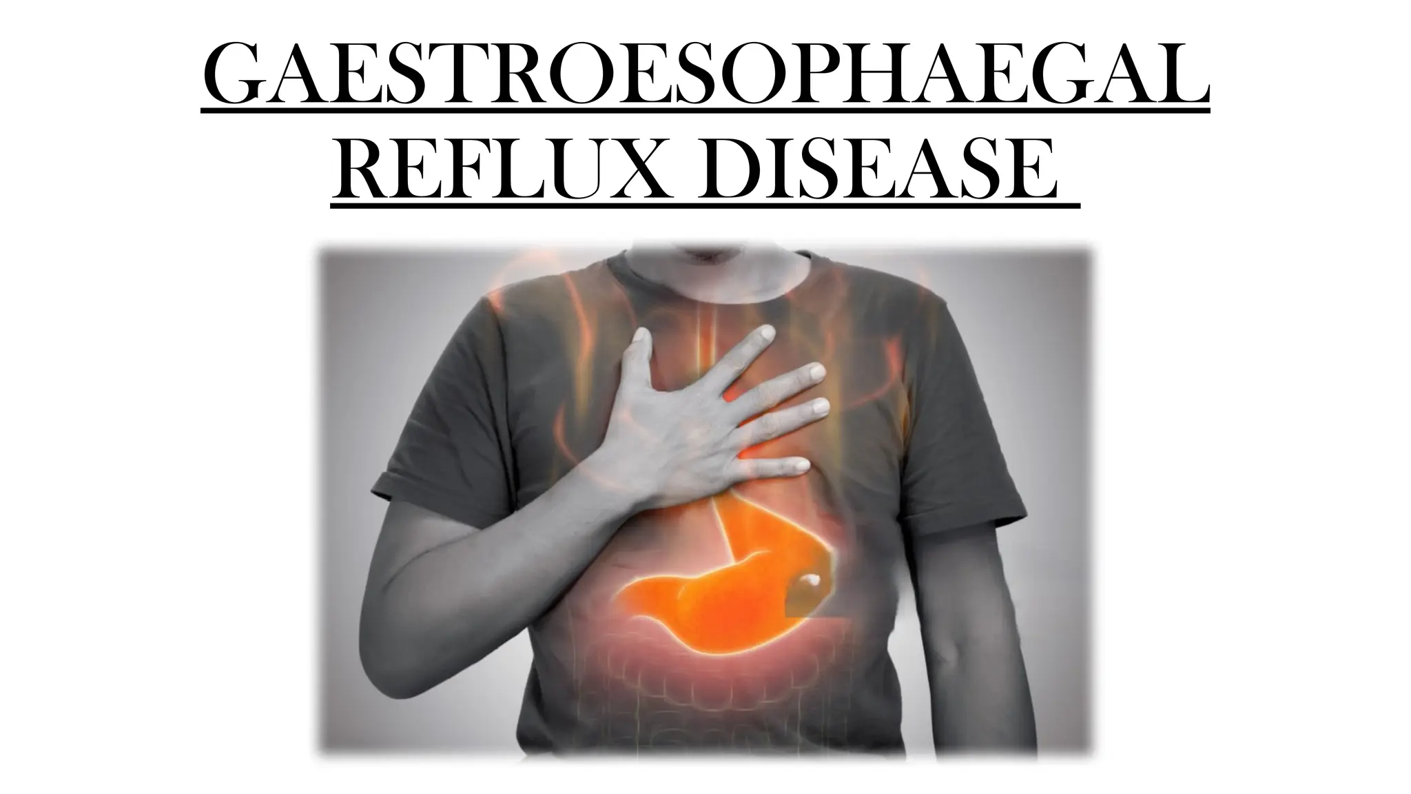 GAESTROESOPHAEGAL REFLUX DISEASE PROJECT | PPTX