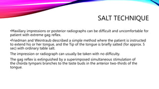gagging and its management in prosthodontics 2.pptx