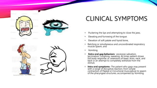 gagging and its management in prosthodontics 2.pptx