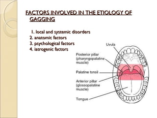 Gag reflex | PPT