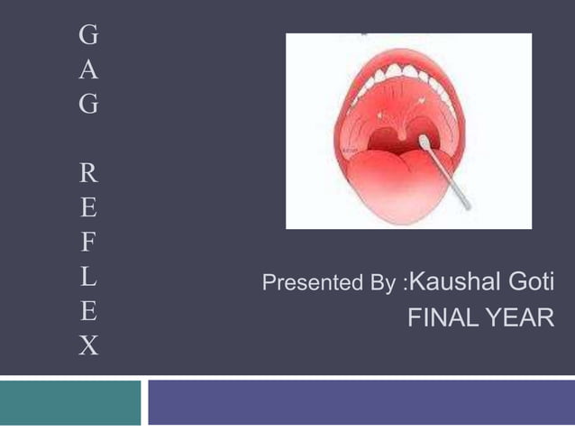 Gag reflex | PPTX | Dental Health | Diseases and Conditions