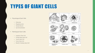 GIANT CELLS | PPTX